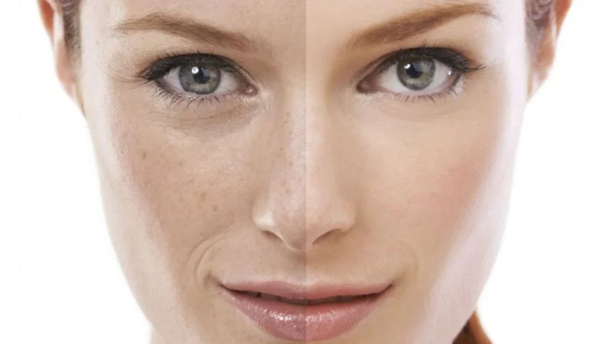 From Dull to Dazzling: How Veneajelu Can Revitalize Your Complexion
